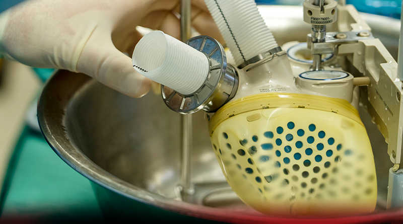 First-in-World Heart Implant at UofL Health – Jewish Hospital – MD Update